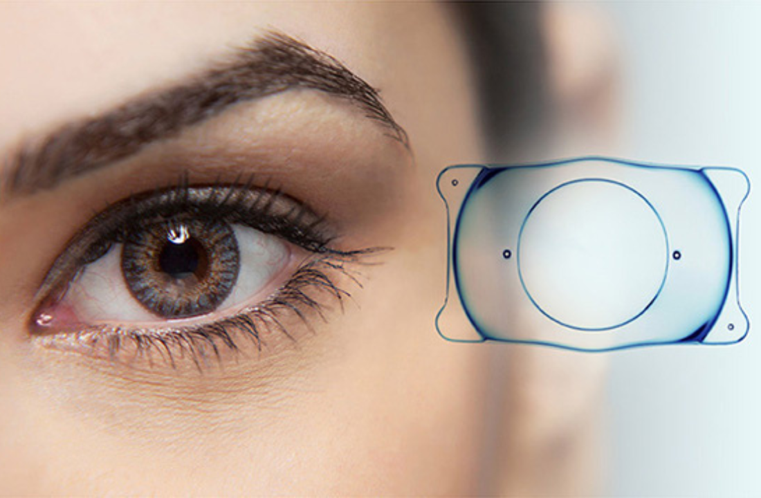 Best ICL Surgery in Nagpur | Ikshan Eye Hospital
