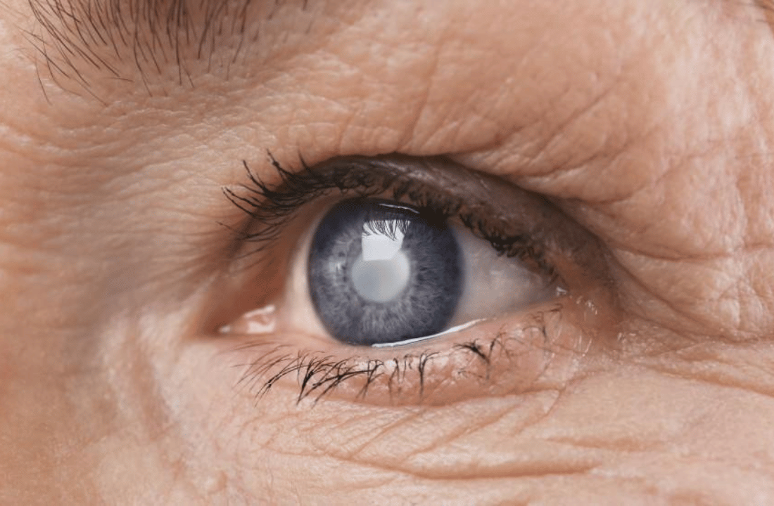 Best Glaucoma Clinic in Nagpur | Ikshan Eye Hospital