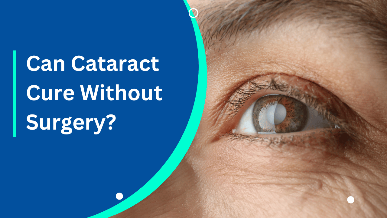 Can Cataract Cure without Surgery – Is It Possible?