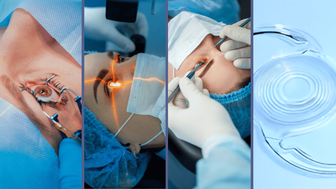 Types of Cataract Surgery in India - Which is right for you?