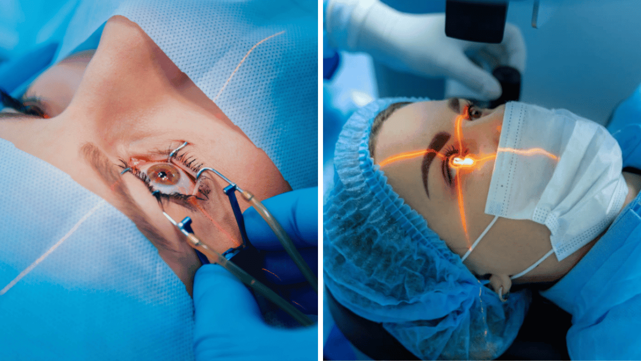 Phacoemulsification vs laser cataract surgery 2025
