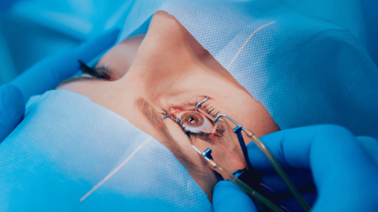 Types of Cataract Surgery in India - Which is right for you?