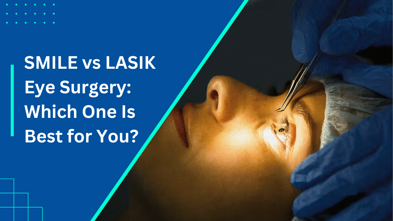 SMILE vs LASIK Eye Surgery: Which One Is Best for You? 2025
