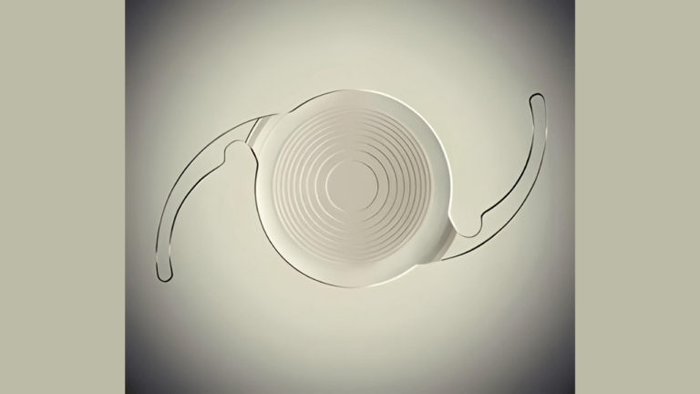 Multifocal IOL: Cost, Benefits & Side Effects Explained 2025
