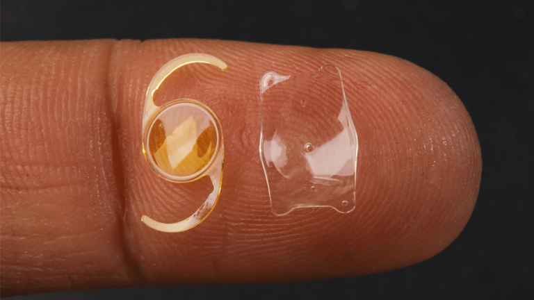 Trifocal IOL: Cost, Benefits & Side Effects 2025