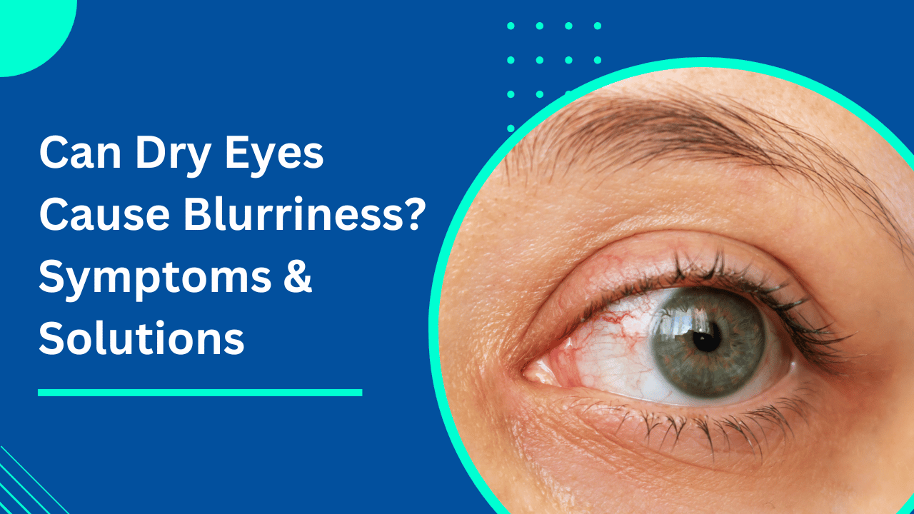 Can Dry Eyes Cause Blurriness? Symptoms & Solutions in 2025